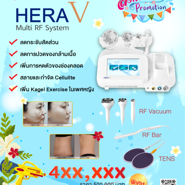 โปรโมชั่น | M I T